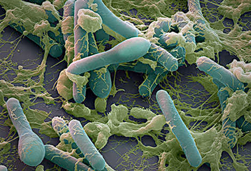 Ganaderos del Meta conocerán el manejo de la clostridiosis en rumiantes ...